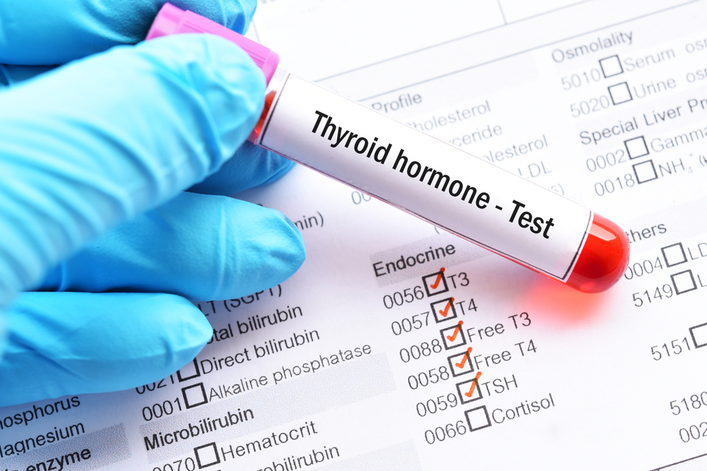 8 Signs That Your Thyroid Hormones Are Out Of Balance Whitehall Of 